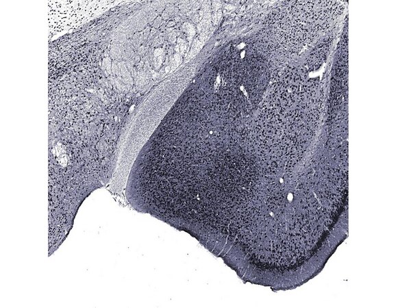 Milli-Mark™ Pan Neuronal Marker | MAB2300